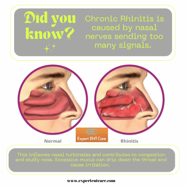 Runny Noses Find Lasting Relief - Expert ENT Care